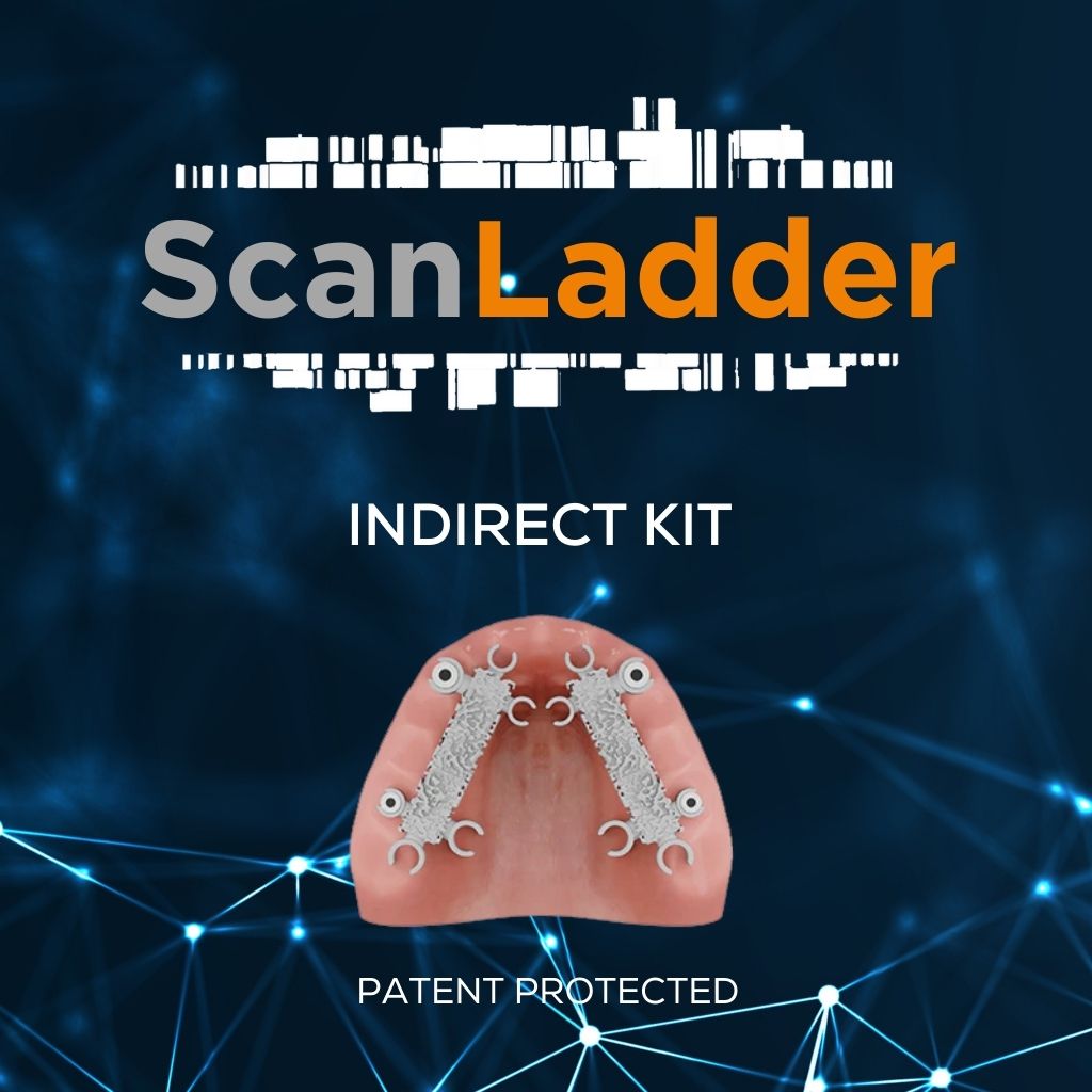 Scan Ladder INDIRECT Kit