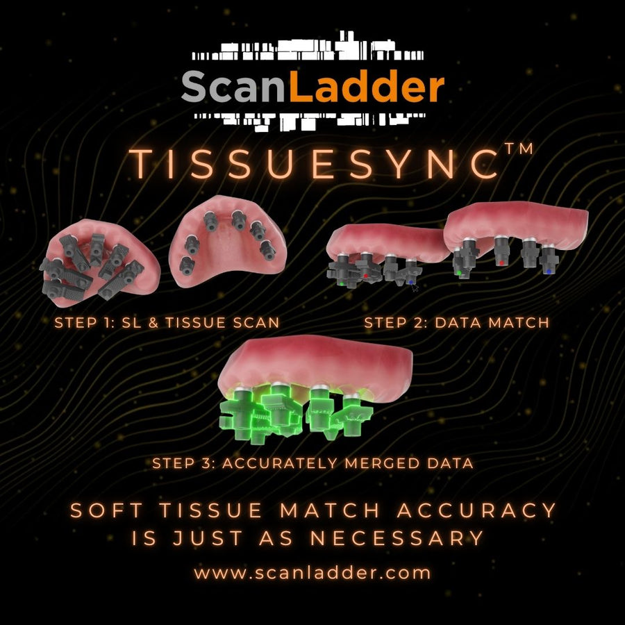 How Scan Ladder Works: Step-by-Step Guide and Insights