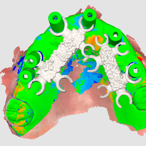 How It Works – Scan Ladder