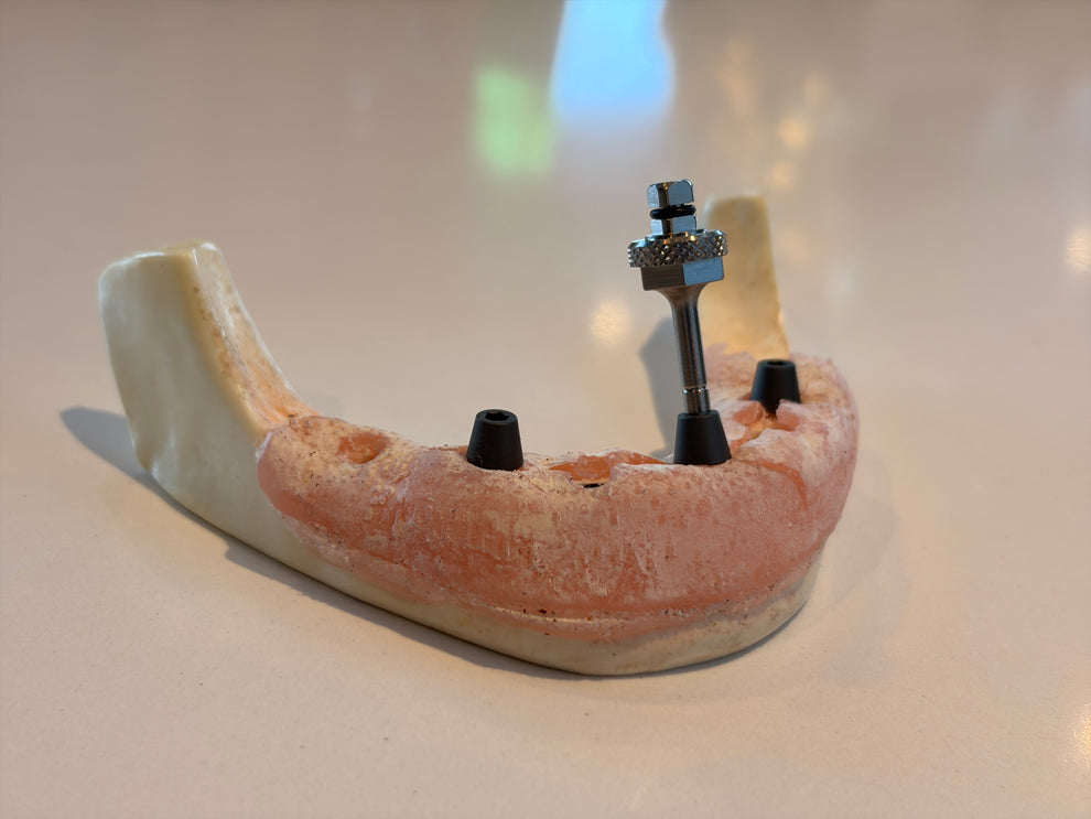 Scan Ladder GuideLock | Guided Implant Surgery Reference System