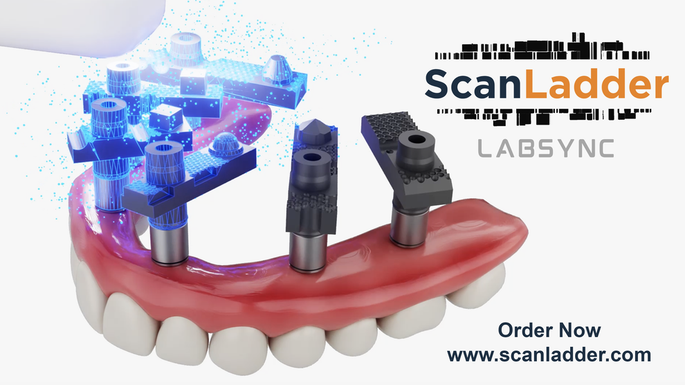Scan Ladder LabSync Titanium Scan Bodies for Full Arch
