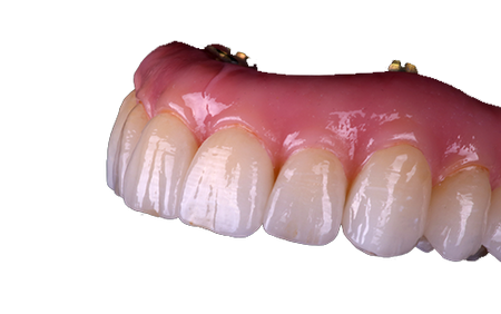 How It Works – Scan Ladder