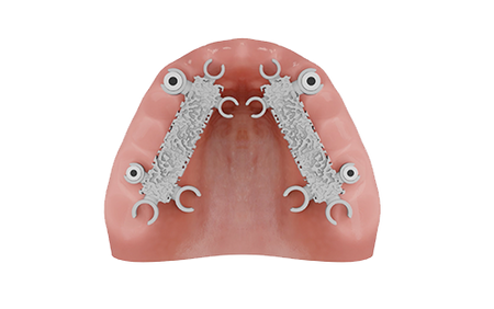 How It Works – Scan Ladder