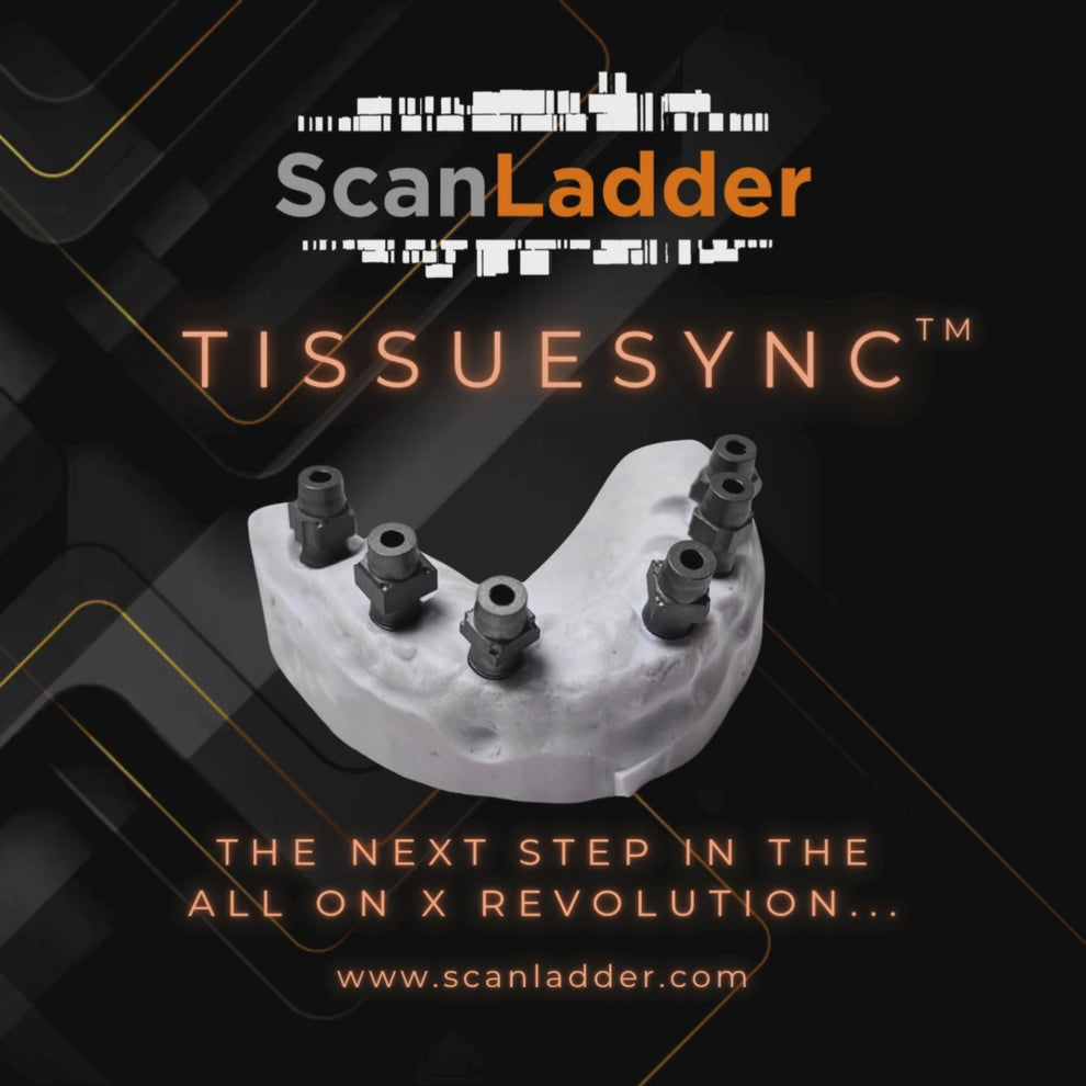 Scan Ladder Titanium Direct TissueSync Scanbody Set