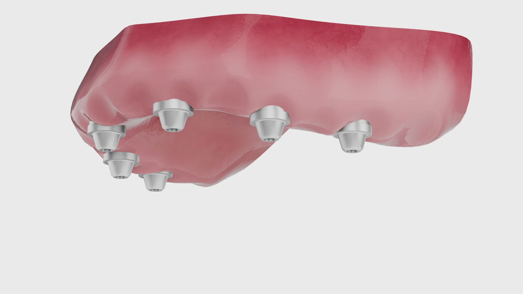 Scan Ladder Titanium Direct Kit NEW! Preorder Now!