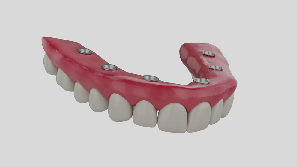 Scan Ladder LabSync Titanium Scan Bodies for Full Arch