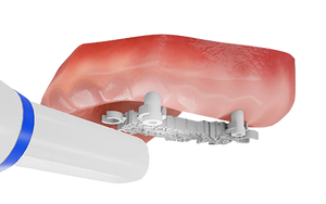 How It Works – Scan Ladder