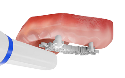 How It Works – Scan Ladder