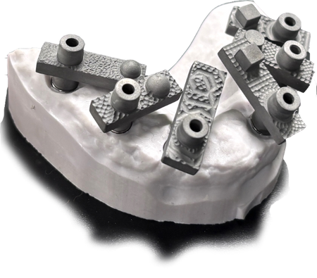 How It Works – Scan Ladder